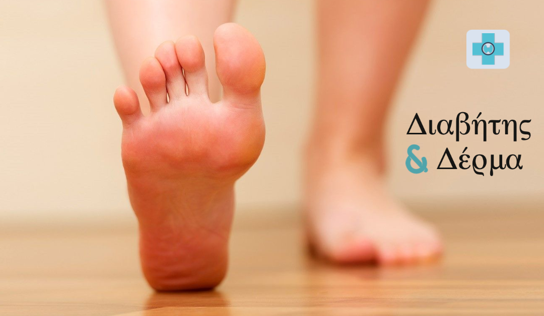 Διαβήτης και δέρμα - Προκοπίου Μαρία